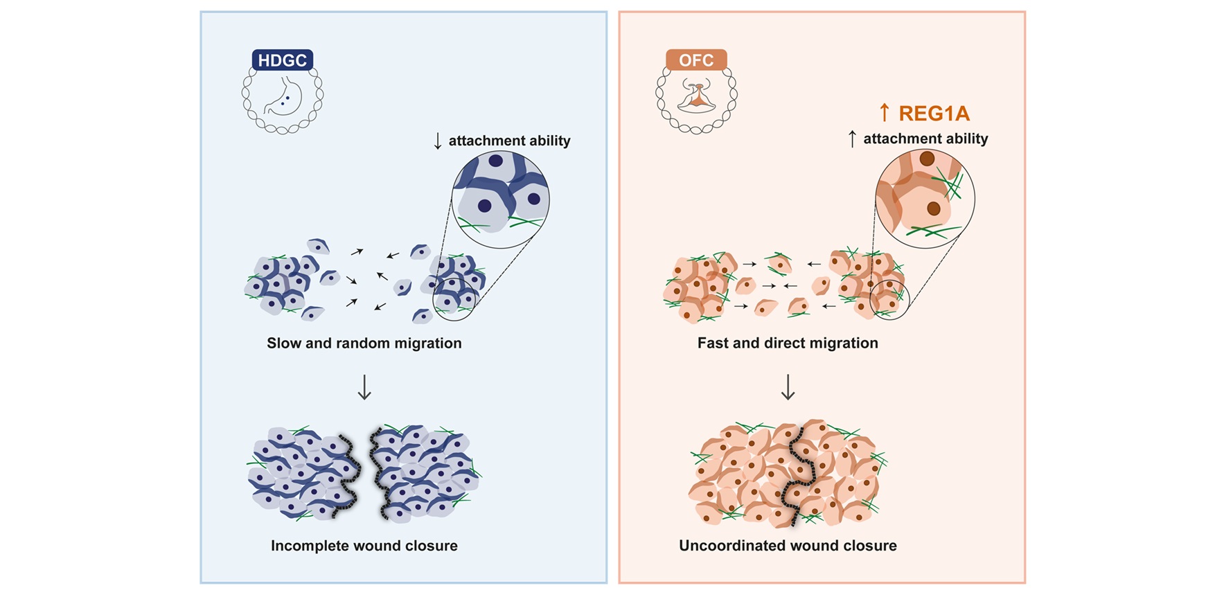 E-cadherin variants associated with oral facial clefts trigger aberrant ...