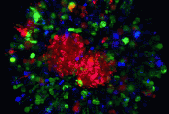 Introducing innate immunity to 3D tumour models | ASPIC